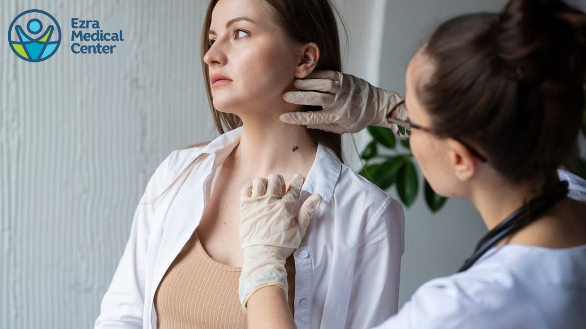 Monthly Skin Check Guide: How the ABCDE Rule Helps You Spot Skin ...